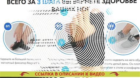🤢 ШИШКА НА НОГЕ ВОЗЛЕ БОЛЬШОГО ПАЛЬЦА ОПЕРАЦИЯ ⚡ КОСТОЧКА НА БОЛЬШОМ ПАЛЬЦЕ НОГИ НАРОДНОЕ ЛЕЧЕНИЕ
