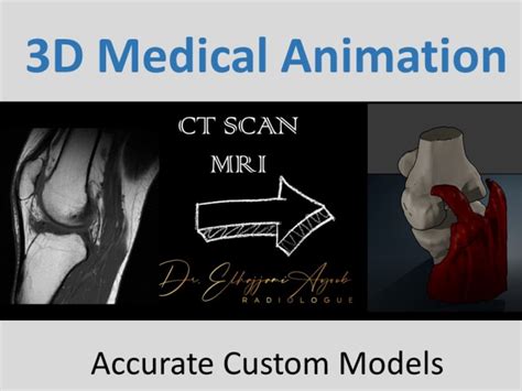 Create A Medical 3d Animation Based On Your Ct Or Mri By Ayoubelhajjami