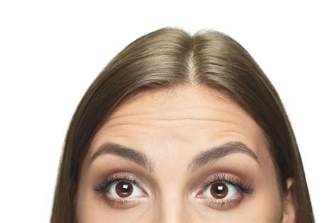 Fine Lines Vs Wrinkles Kenali Bedanya Dan Cara Mengatasinya