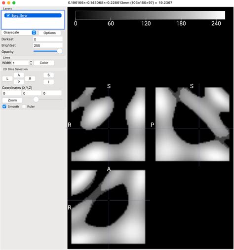 Mrtrix Tckgen Usage Help Mrtrix3 Community