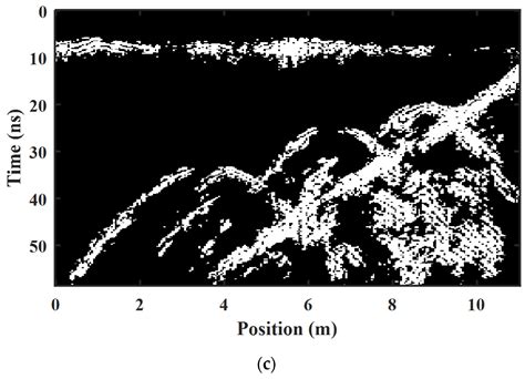 Roi Binarized Hyperbolic Region Segmentation And Characterization By Using Deep Residual