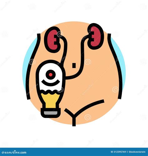 Urostomy Urology Color Icon Vector Illustration Stock Vector Illustration Of Color Infection