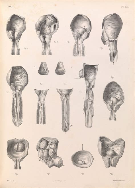 Plate 71 Surgical Anatomy Perineum Free Photo Illustration Rawpixel