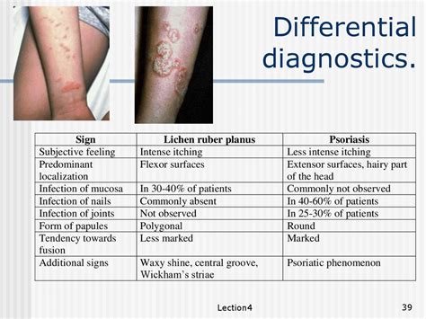 Psoriasis And Lichen Online Presentation