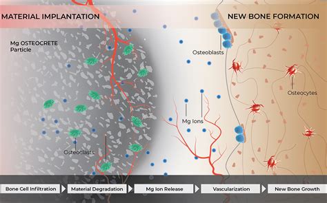Technology Bone Solutions New