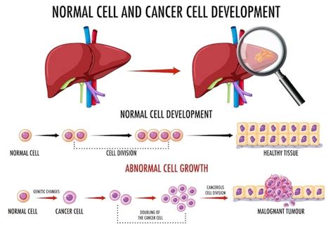 Healthy Skin Hub Basal Cell Cancer Mohs Surgery A Comprehensive Guide