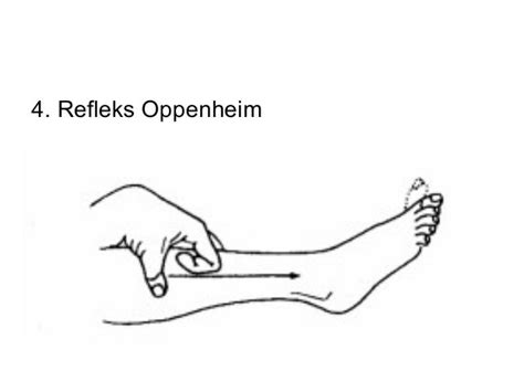 Pemfis Neurologidons