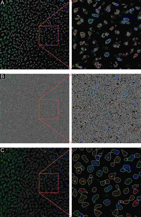 A Watershed Based Algorithm To Segment And Classify Cells In Fluorescence Microscopy Images Deepai