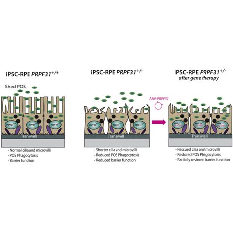 Aav Mediated Gene Augmentation Therapy Restores Critical Functions In Mutant Prpf31 − Ipsc