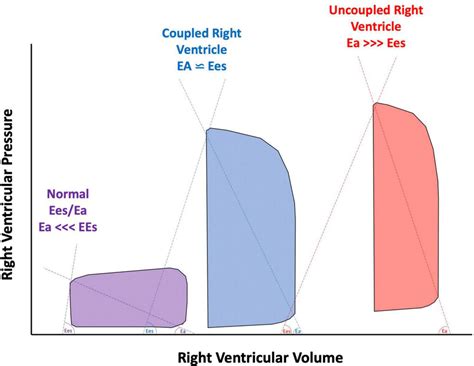 Pressure Volume Loops Of A Normal Right Ventricle Rv Compared To A Download Scientific