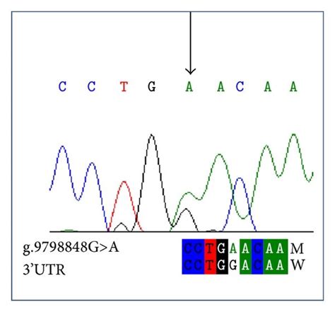 Sequencing Electropherogram Of Polymorphisms Of Ogg1 A B C Download Scientific