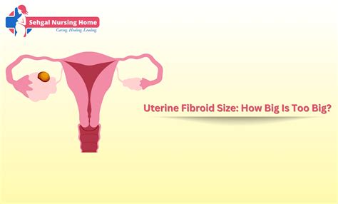 Uterine Fibroid Size How Big Is Too Big