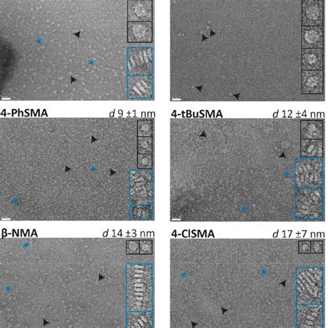 Negative Stain Transmission Electron Micrographs Of Nanodiscs Composed