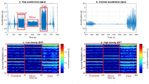 Figure 4 From Using Lower Limb Wearable Sensors To Identify Gait Modalities A Machine Learning
