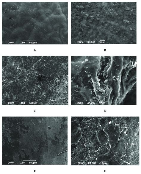 Electron Microscopic Image Of The Amniotic Membrane In A Scanning Download Scientific Diagram