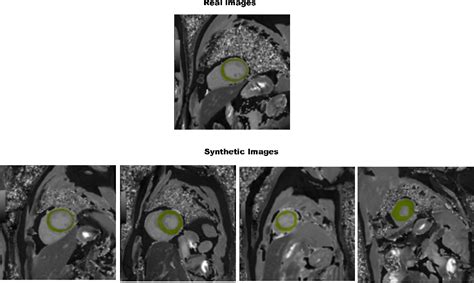 Federated Data Model Paper And Code Catalyzex