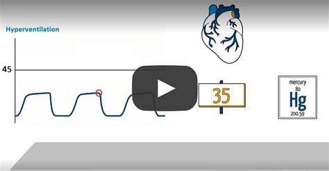 Learn About Capnography Waveforms And Hyperventilation Penny Stapf