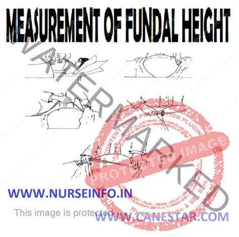 Measurement Of Fundal Height Nurse Info