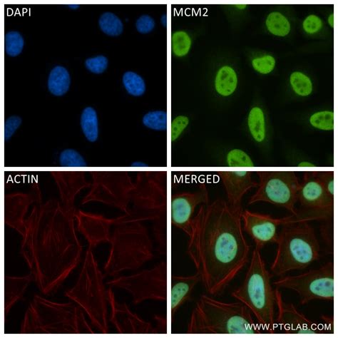 Mcm2 Antibody 84511 2 Rr Proteintech