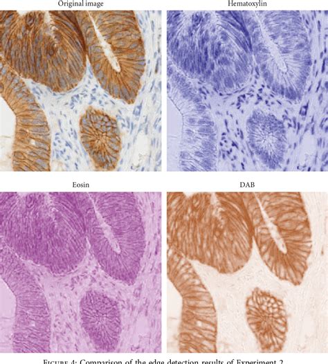 Figure 4 From Fractal Visual Art Graphic Design Based On Computer Aided Algorithms Semantic