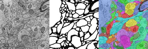 Automatic Segmentation Of Neural Tissue In 3d Electron Microscopy Images Using Deep Learning The La