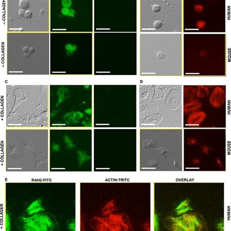 Mouse Tail Bleeding Assay Tail Bleeding Test Was Done With Three Pairs