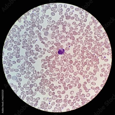 Basophil Under Microscope