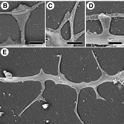 Morphology Of Dendritic Spines A D And Dendritic Filopodia E H Download Scientific Diagram