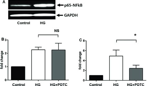 Effects Of The Nf κb Inhibitor Pdtc On High Glucose 30 Mm Medium