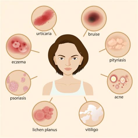 Skin Conditions Dermatology Compounding Houston