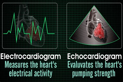 Electrocardiogram Ecg And Echocardiography A Ecg Showing Sinus Hot Sex Picture