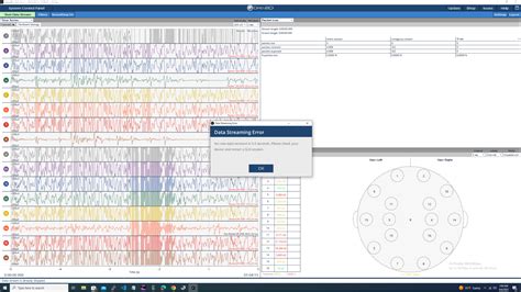 Troubleshooting Clarification Beginner OpenBCI Forum