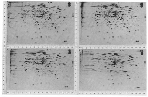 Proteomics And The Importance Of Spatial Distribution