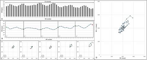A Heart Rate Tachogram B R R Tachogram And C D Poincaré Plot Download Scientific Diagram