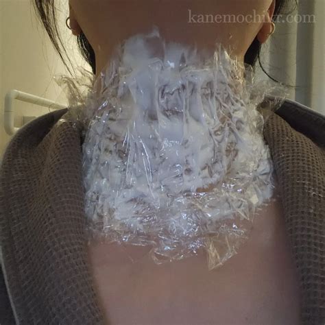 목 쥐젖 편평사마귀 100개이상 레이저 제거후기 비용 가격｜제거 후 관리방법