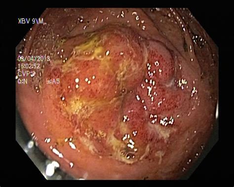 Simulamet Hostkvasir Vqa · Datasets At Hugging Face