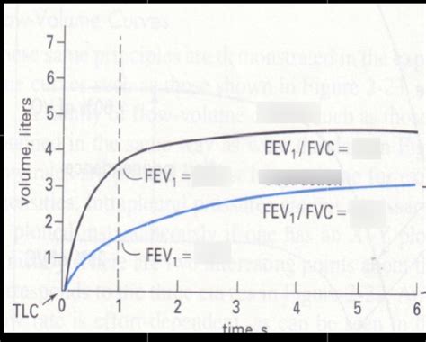 Fvc And Fev1 Diagram Quizlet