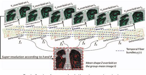 Figure 1 From Estimating The 4d Respiratory Lung Motion By Spatiotemporal Registration And Super