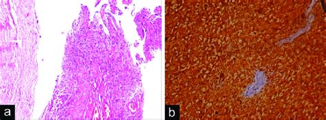 A Hande Stained ×40 Photomicrograph Of The Specimen Showing A Download Scientific Diagram