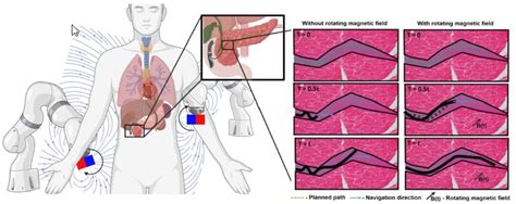 Innovative Magnetic Robotic Catheters A Step Forward In Minimally Invasive Surgery Storm Lab Uk
