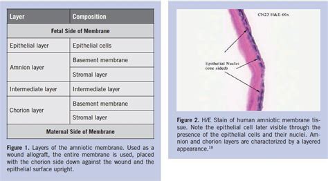Amniotic Membrane Layers Ophthalmology Notes And Synopses
