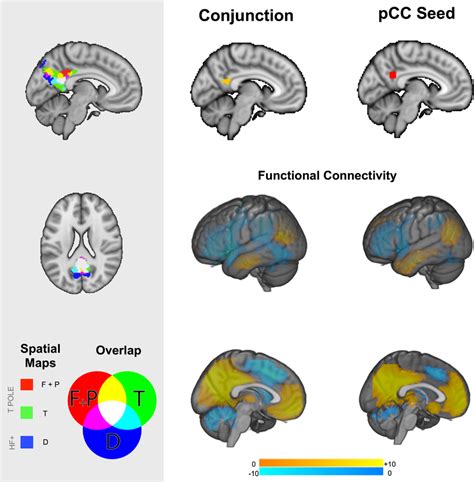 The Posterior Cingulate Cortex Is A Hub Integrating Different Forms Of