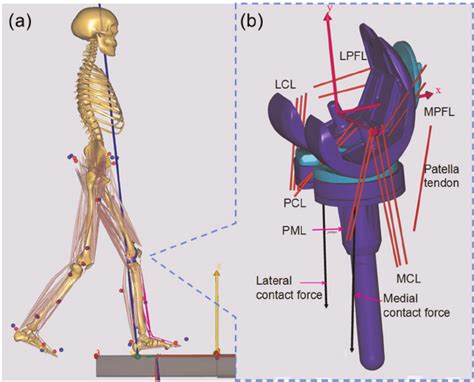 A Full Lower Limb Musculoskeletal Model Of Tkr In Anybody Combing A Download Scientific