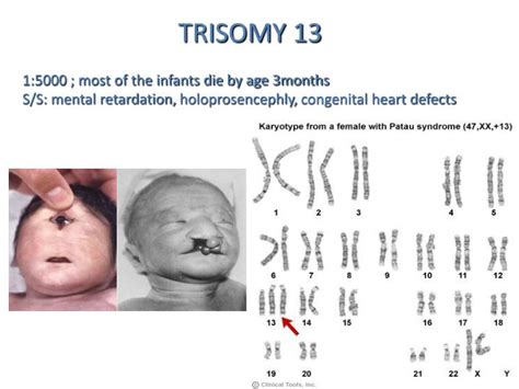 Ppt Chromosomal Abnormalities Powerpoint Presentation Id5719987