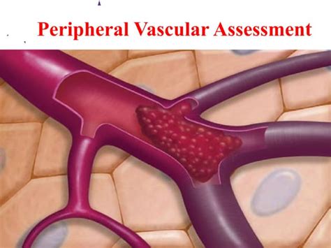 Cm3 Cu13 Assessment Of Peripheral Vascular Systempdf