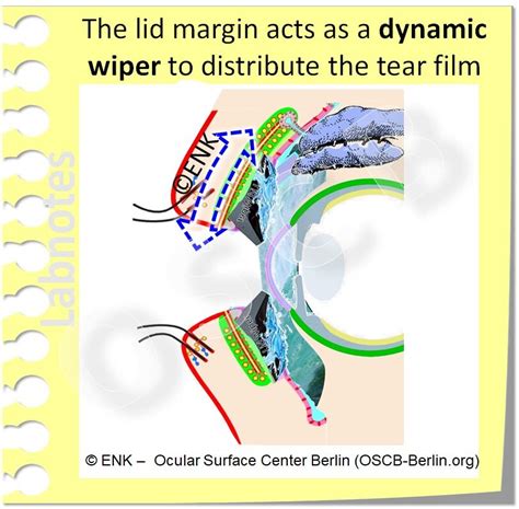 Glimpse On The Lid Margin — Ocular Surface Center Berlin