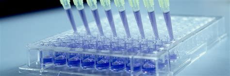 Enzyme Linked Immunosorbent Assay Elisa Protocols