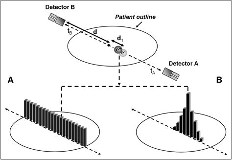 Dual Modality Imaging Combining Anatomy And Function Journal Of Nuclear Medicine