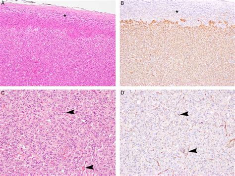 Serial Hematoxlin And Eosin Stained A C 2sc Ihc Stained B And Fh