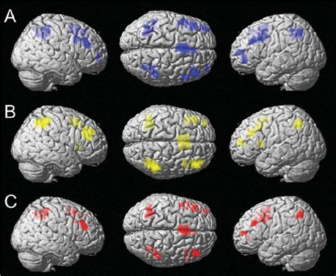 Panel A Blue Shows Activation In The Physical Stroop Task While Download Scientific Diagram